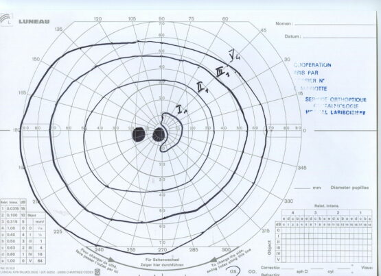 Anomalie de la vision d'apparition brutale : diagnostic et traitement