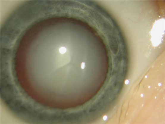 Suivi et diagnostic des troubles visuels chez l'enfant - Clinique ...